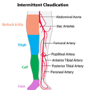Arterial and Venous Disorders - Focus Dentistry
