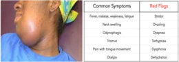 Ludwig's Angina - Focus Dentistry