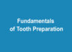 Fundamentals of Tooth Preparation - Focus Dentistry