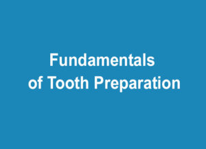 Fundamentals of Tooth Preparation - Focus Dentistry