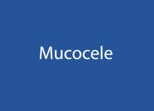 Mucocele - Focus Dentistry
